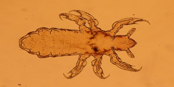 What is the Life Cycle of a Louse? - My Hair Helpers